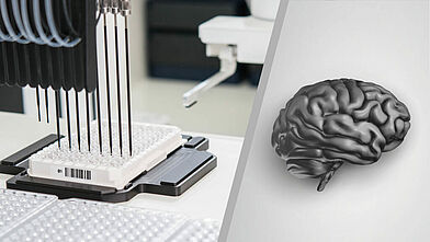 Your partner for the diagnostic laboratory | EUROIMMUN