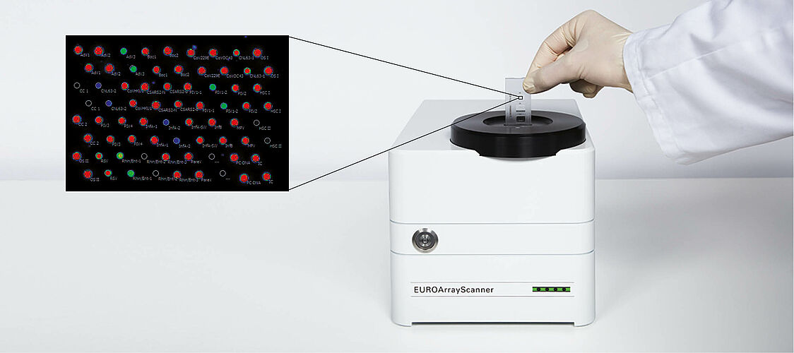 Your partner for the diagnostic laboratory | EUROIMMUN